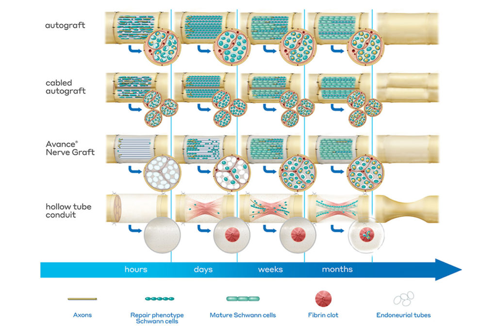 Treat nerve damage | axogen