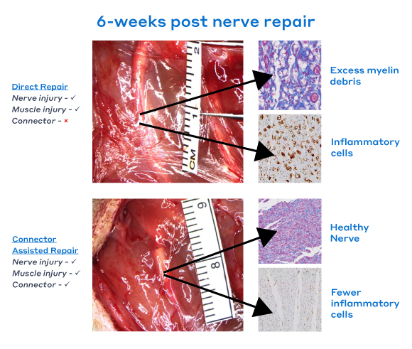 for small gap, digital nerve repair,how often is primary repair really ...